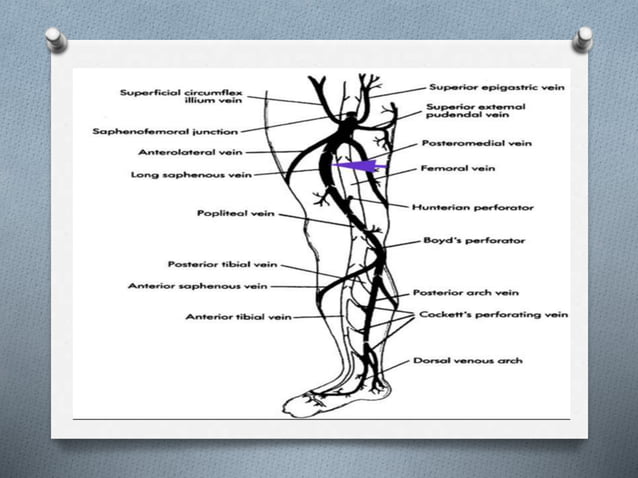 Anatomy of venous system of lower limb | PPTX