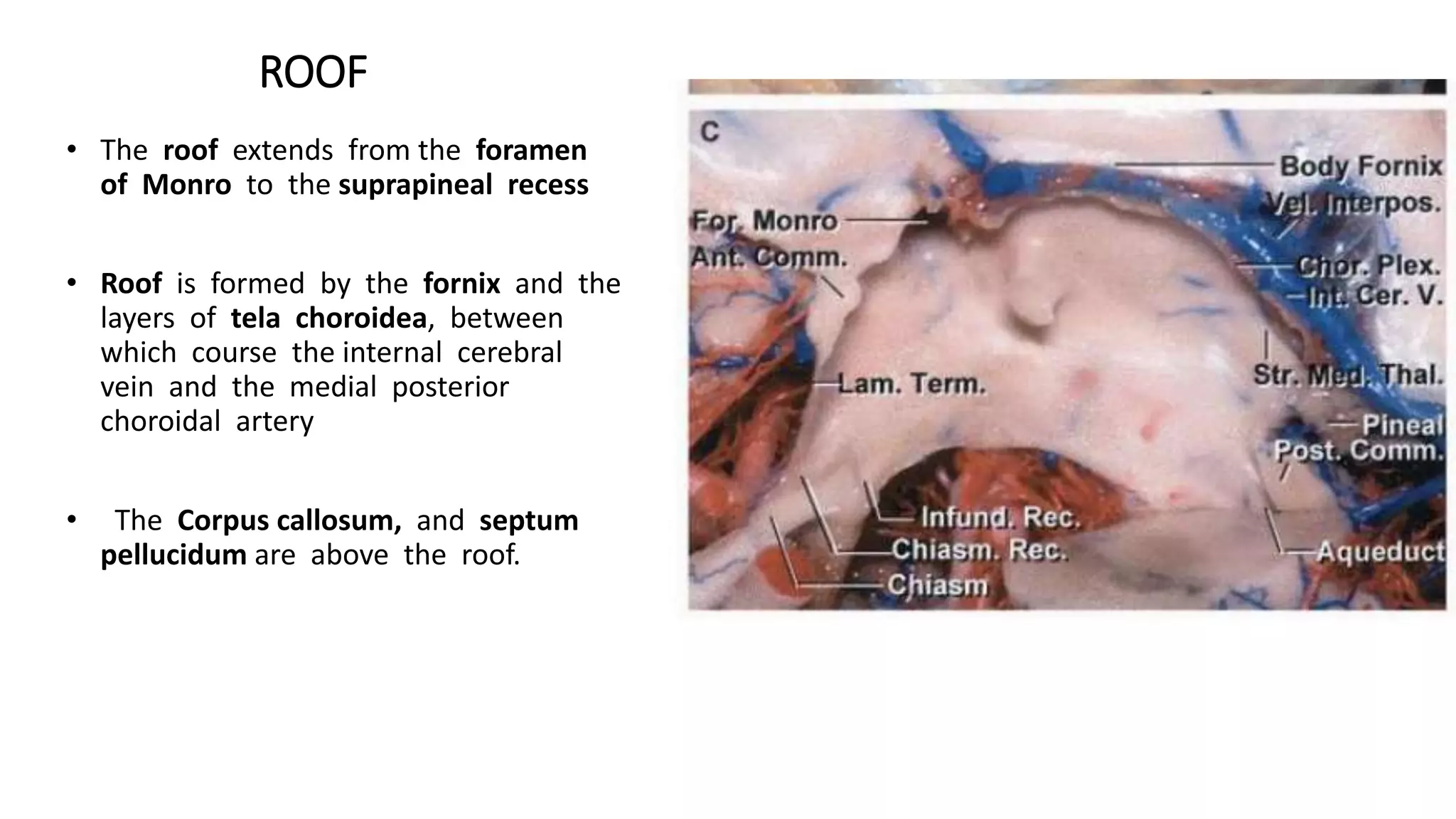 ANATOMY OF VENTRICLES OF BRAIN | PPTX