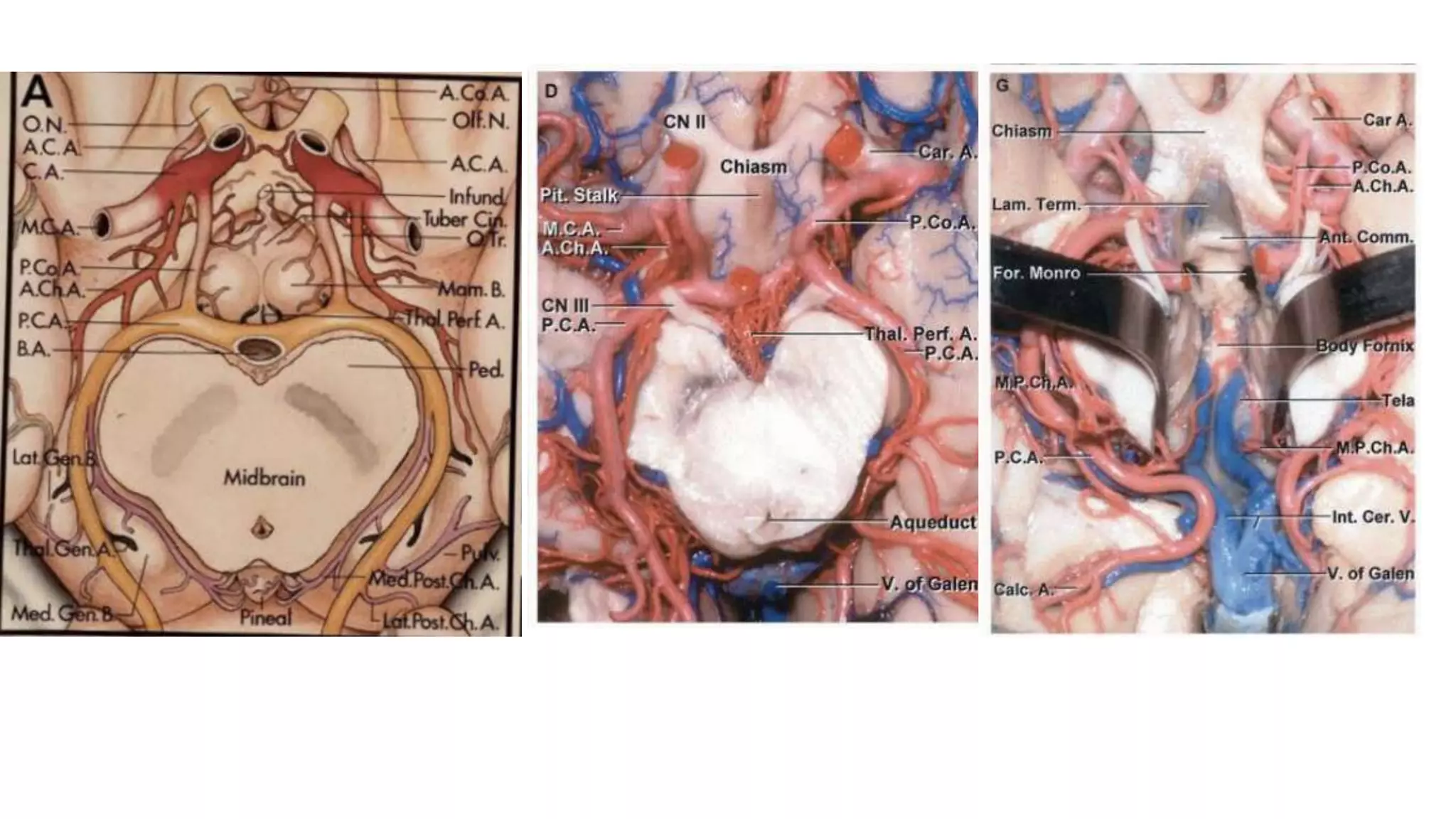 ANATOMY OF VENTRICLES OF BRAIN | PPTX
