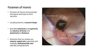 ANATOMY OF VENTRICLES OF BRAIN | PPTX