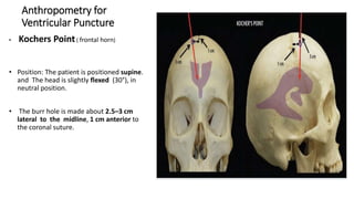 ANATOMY OF VENTRICLES OF BRAIN | PPTX