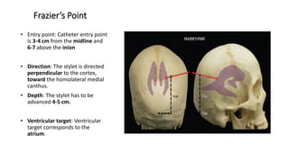 ANATOMY OF VENTRICLES OF BRAIN | PPTX