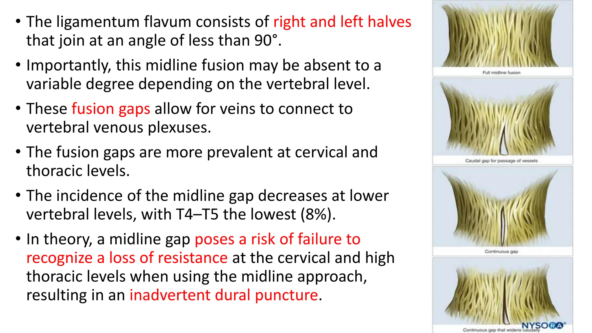 anatomy of vertebral column.pptx