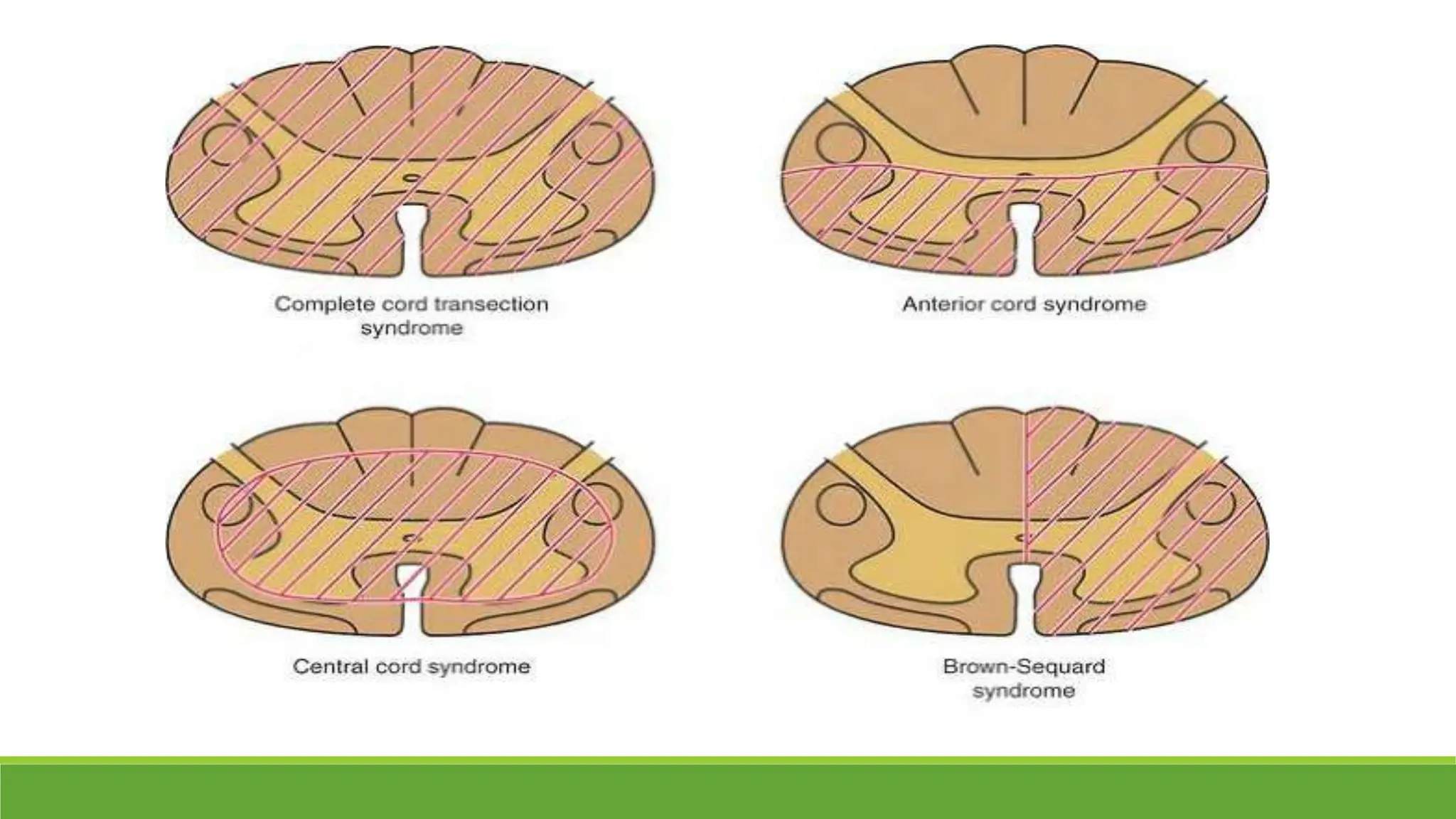 ANATOMY OF VERTEBRAL COLUMN AND SPINAL CORD.pptx