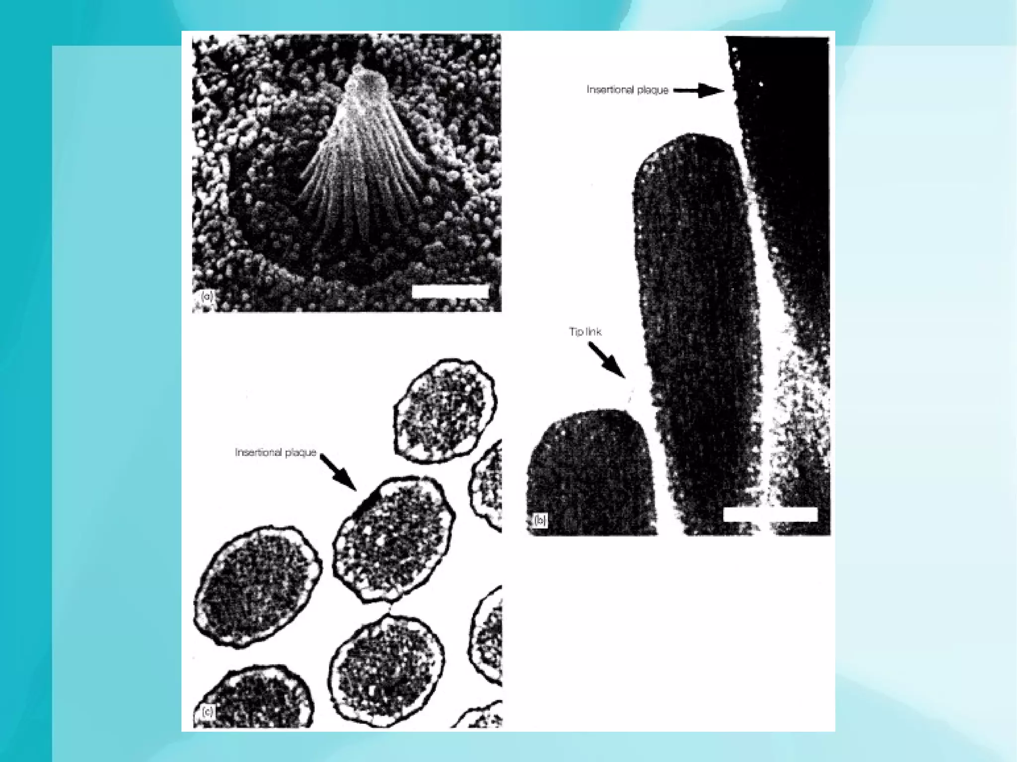 Anatomy of vestibular apparatus | PPT