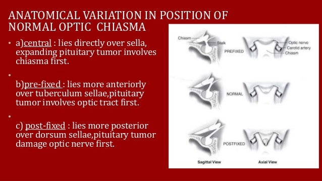 Anatomy OF VISUAL PATHWAY