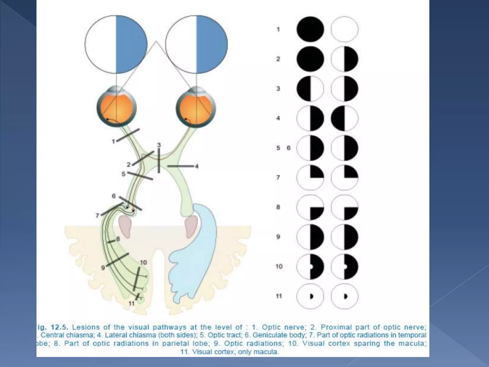 Anatomy of visual pathway | PPTX