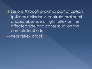 Anatomy of visual pathway | PPTX