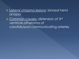 Anatomy of visual pathway | PPTX