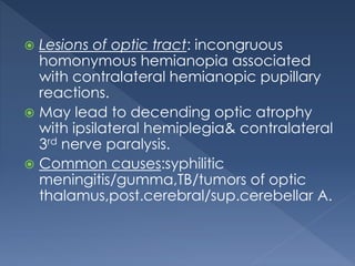 Anatomy of visual pathway | PPTX