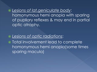 Anatomy of visual pathway | PPTX