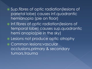 Anatomy of visual pathway | PPTX