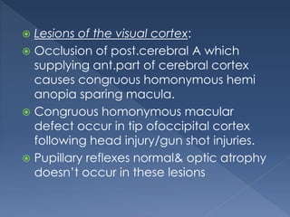 Anatomy of visual pathway | PPTX