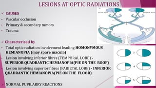 ANATOMY OF VISUAL PATHWAY - DR.RUTHRA.pptx