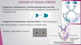 ANATOMY OF VISUAL PATHWAY - DR.RUTHRA.pptx