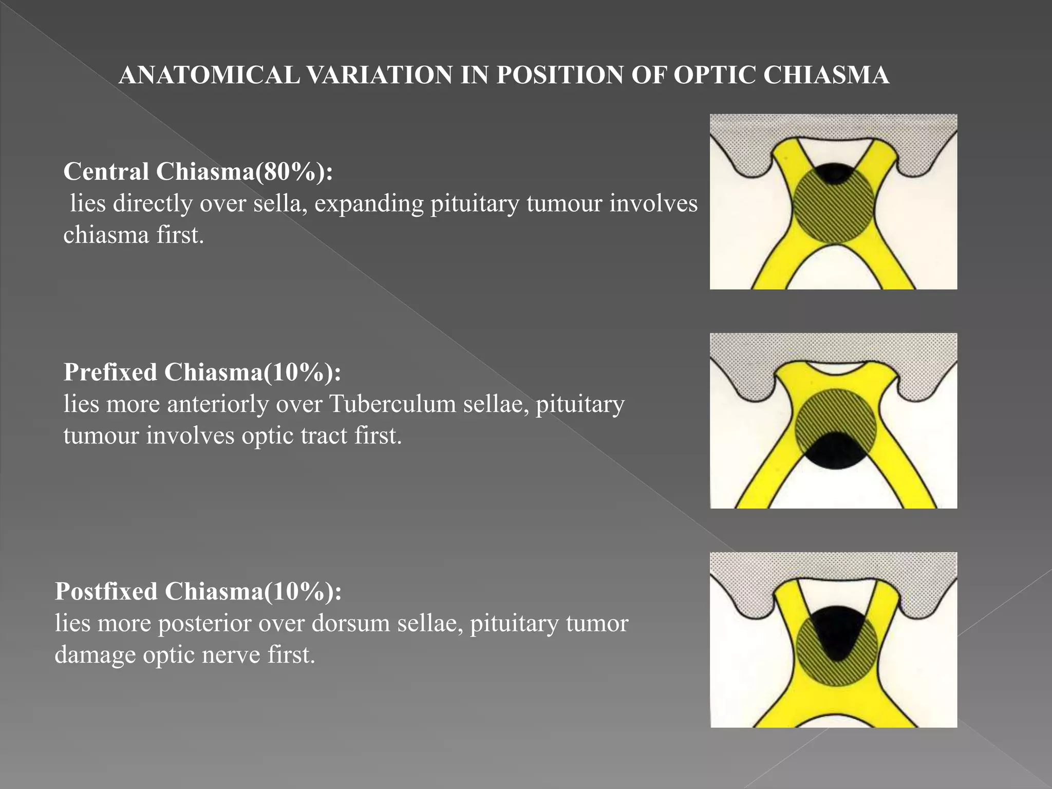 Anatomy of visual pathway and its lesion.pptx