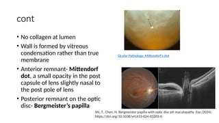 ANATOMY OF VITREOUS- Part 1(anatomy, composition, development)) | PPTX