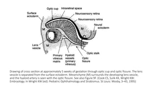 ANATOMY OF VITREOUS- Part 1(anatomy, composition, development)) | PPTX