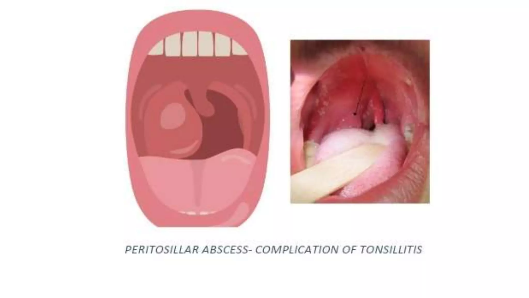 Anatomy of Waldeyers Ring .pptx