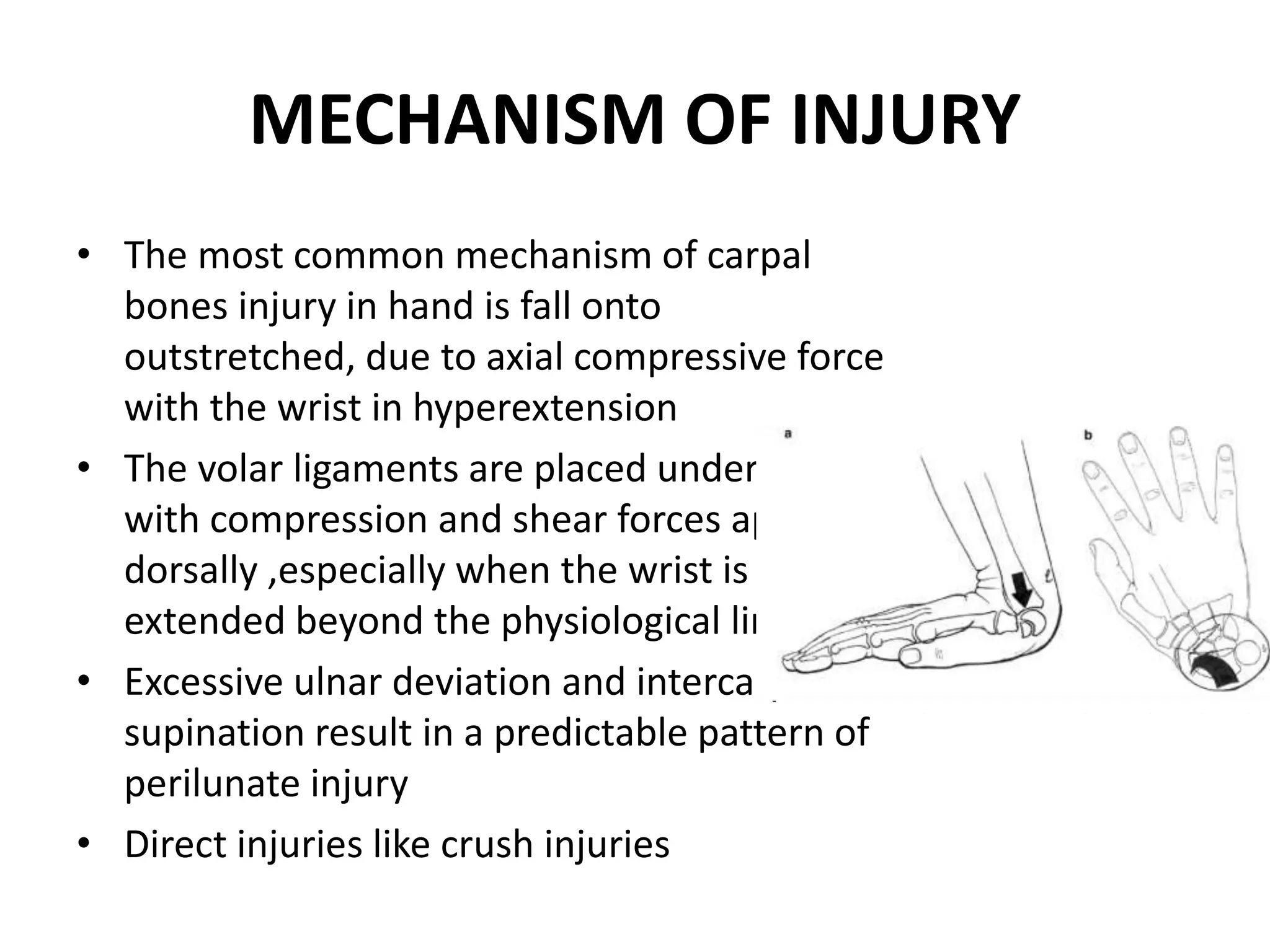 Anatomy of wrist joint | PPTX