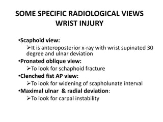 Anatomy of wrist joint | PPTX