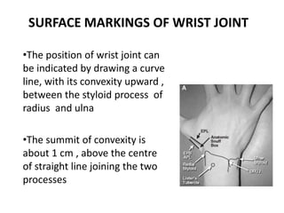 Anatomy of wrist joint | PPTX