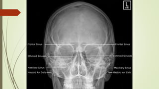 Anatomy of pns | PPTX