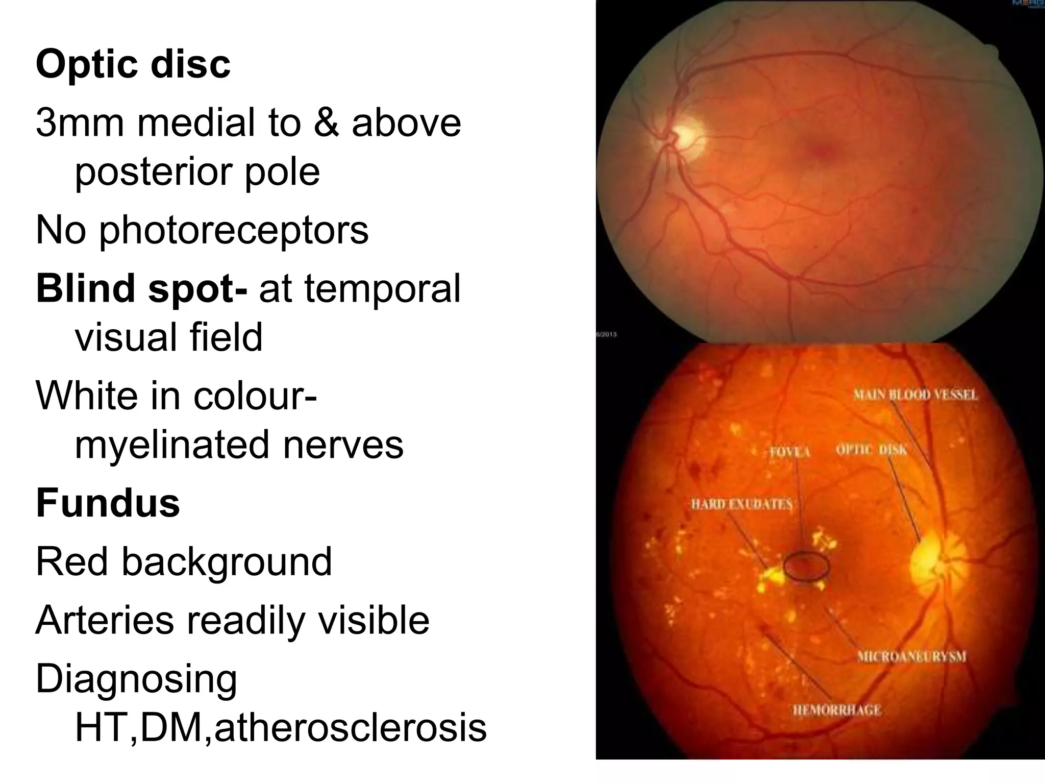 Anatomy, optics & refractive errors of eye | PPT