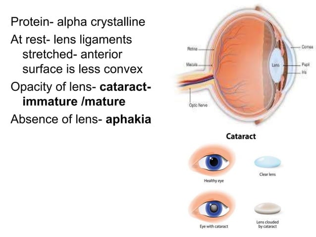 Anatomy, optics & refractive errors of eye | PPT