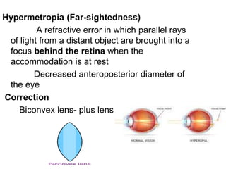 Anatomy, optics & refractive errors of eye | PPT