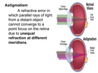 Anatomy, optics & refractive errors of eye | PPT