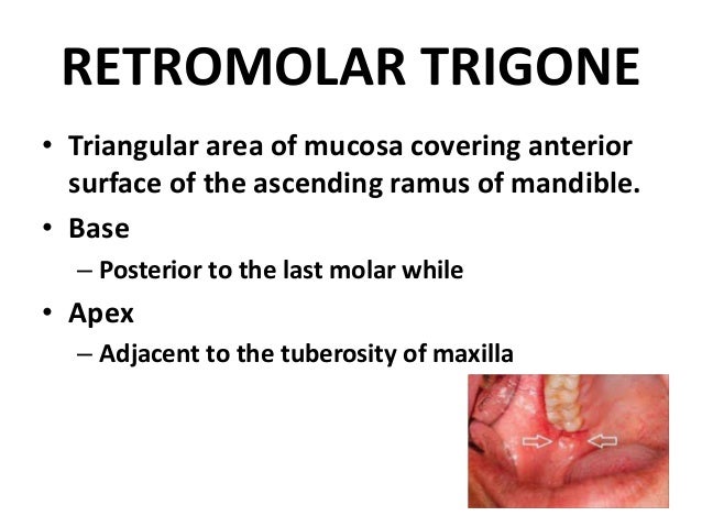 Retromolar Trigone