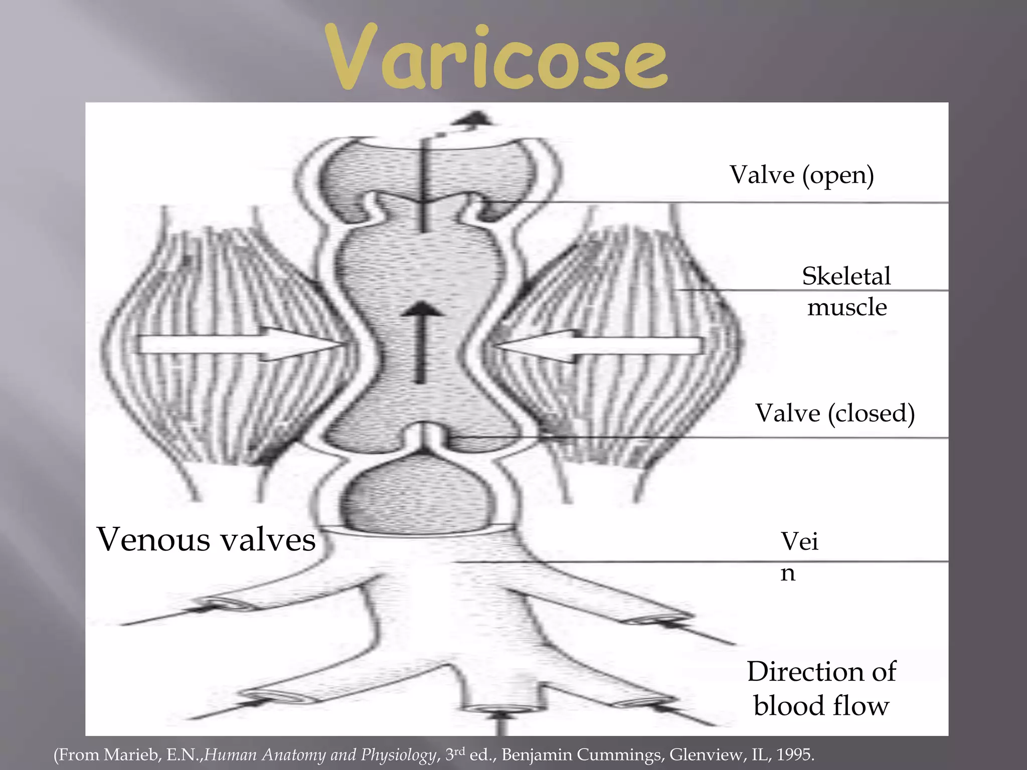 Anatomy and Pathophysiology of venous system of lower limbs | PPTX