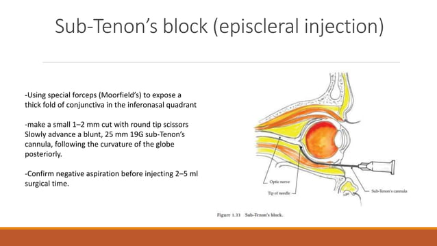 Anatomy & physiology of Brain,Spinl cord Nerve,Eye.pptx