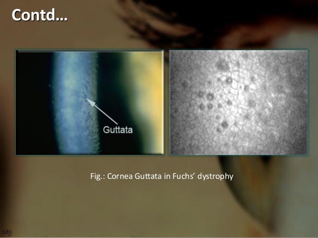 Anatomy & physiology of cornea