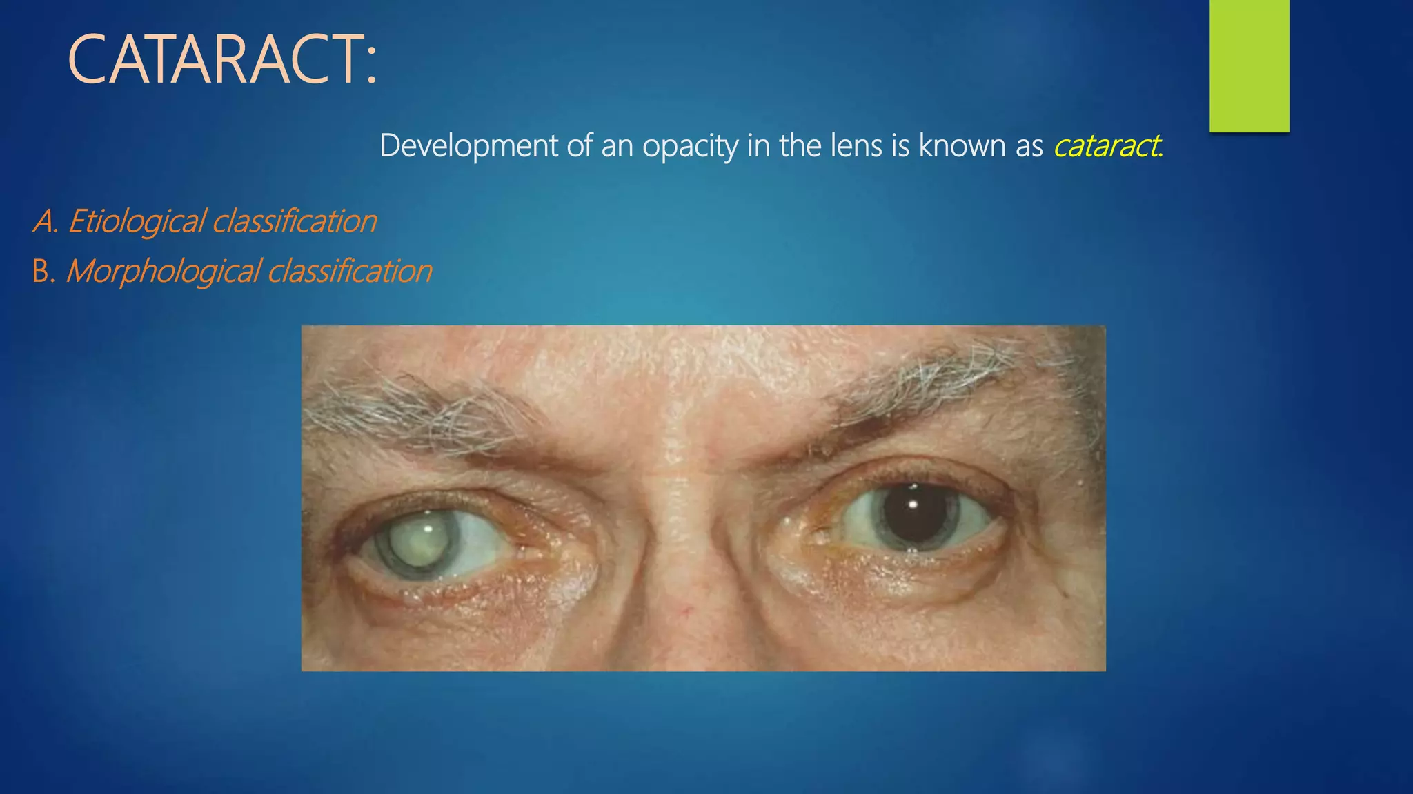 Anatomy & physiology of human eye lens | PPTX