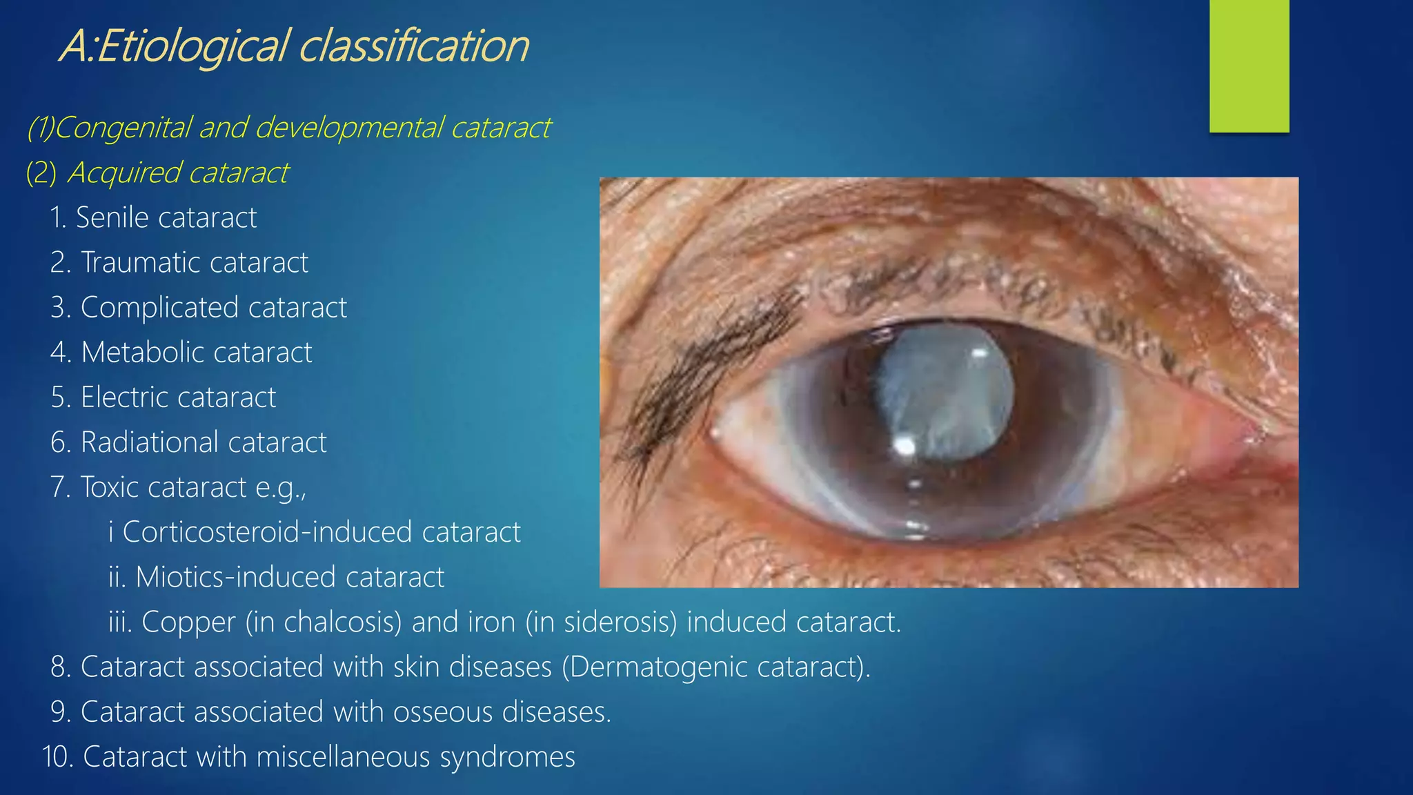 Anatomy & physiology of human eye lens | PPTX