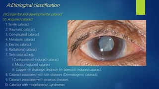 Anatomy & physiology of human eye lens | PPTX