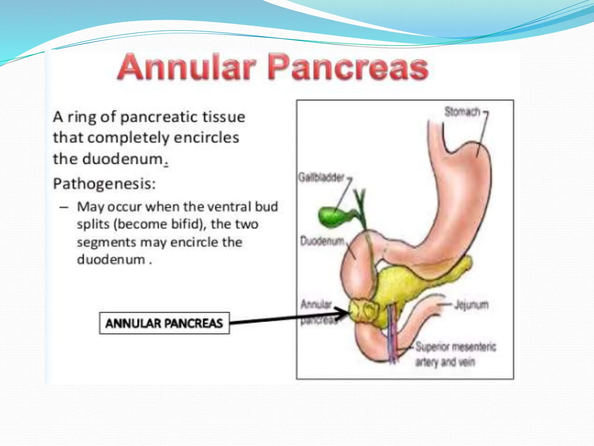 ANATOMY& PHYSIOLOGY OF PANCREAS.pptx by Dr Meena | PPTX | Endocrine and ...