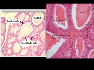 Thyroid Gland Slide Labeled