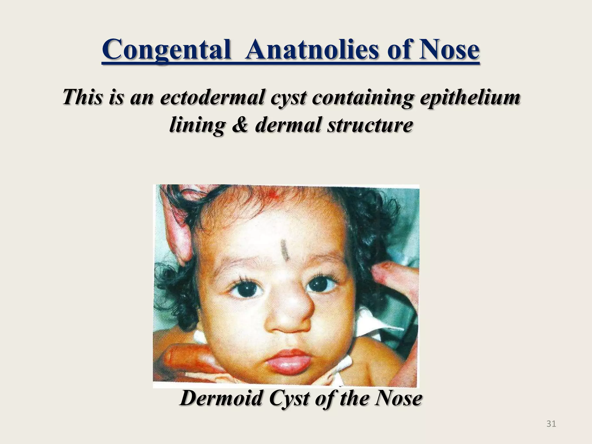 ANATOMY, PHYSIOLOGY & SIGNS SYMPTOMS CONGENITAL ANOMALIES OF NOSE AND ...