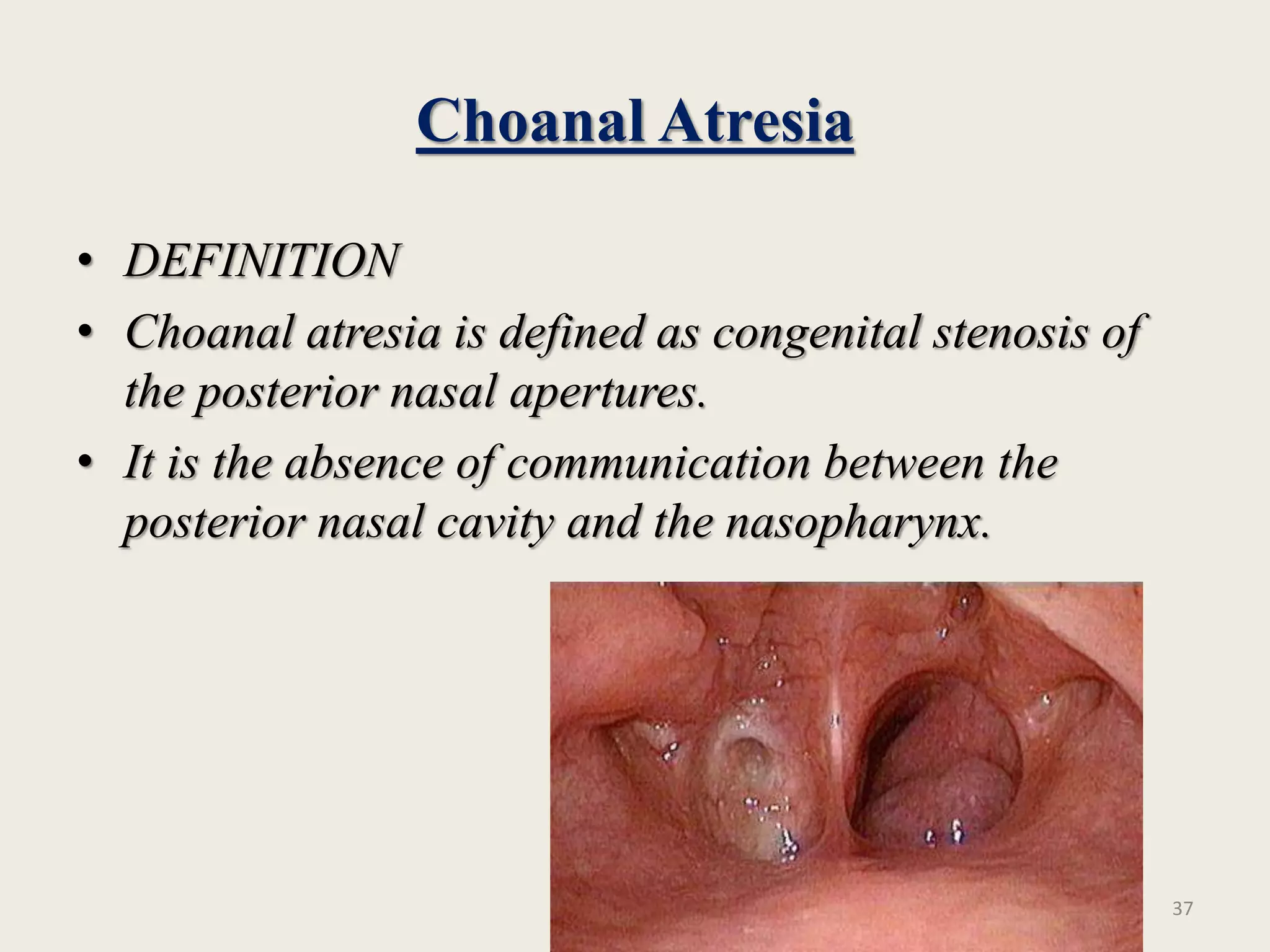 ANATOMY, PHYSIOLOGY & SIGNS SYMPTOMS CONGENITAL ANOMALIES OF NOSE AND ...
