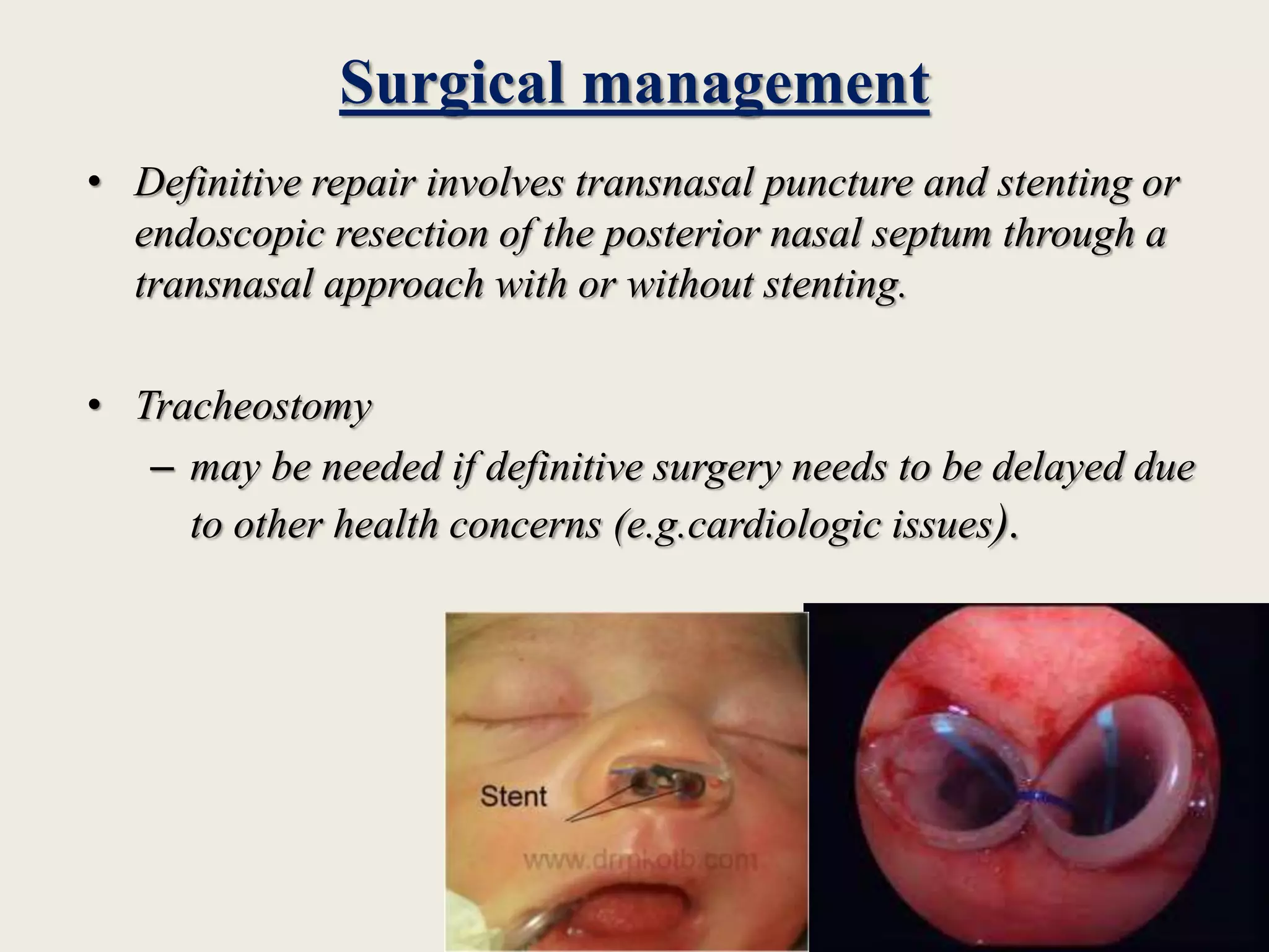 ANATOMY, PHYSIOLOGY & SIGNS SYMPTOMS CONGENITAL ANOMALIES OF NOSE AND ...