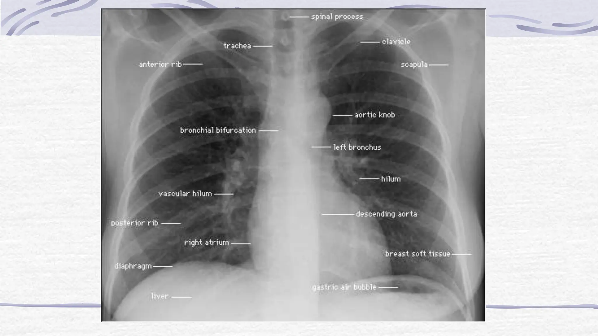 anatomy thorax human title radiologi positioning | PPTX