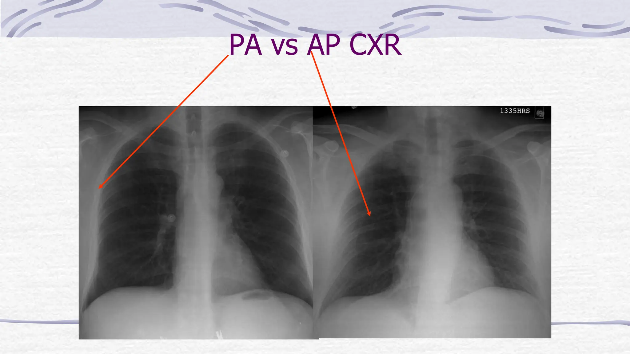 anatomy thorax human title radiologi positioning | PPTX