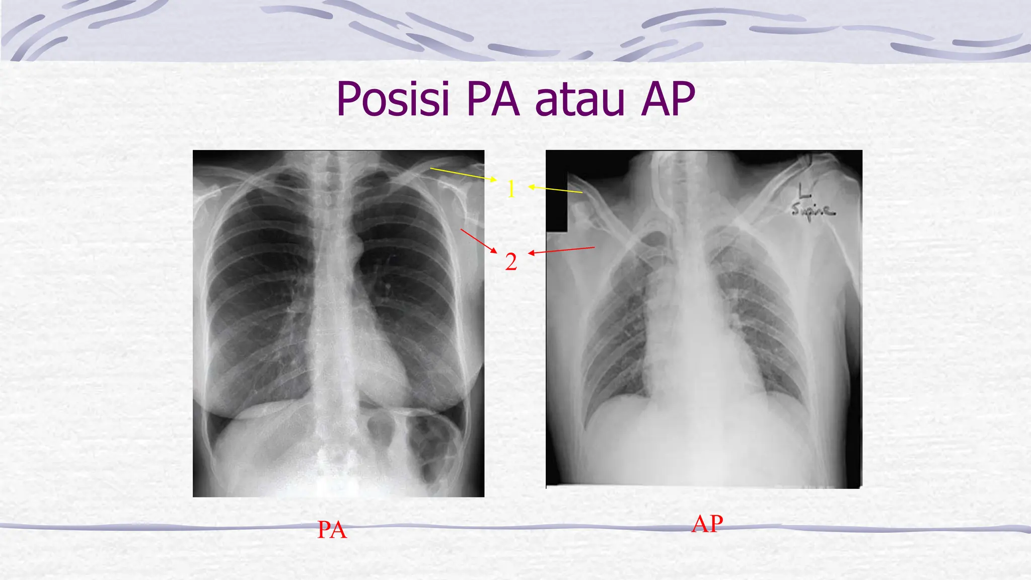 anatomy thorax human title radiologi positioning | PPTX