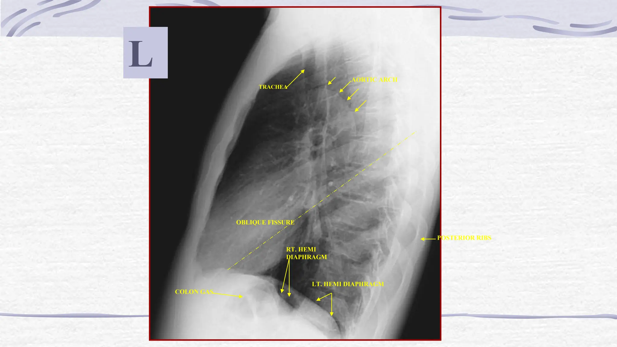 anatomy thorax human title radiologi positioning | PPTX