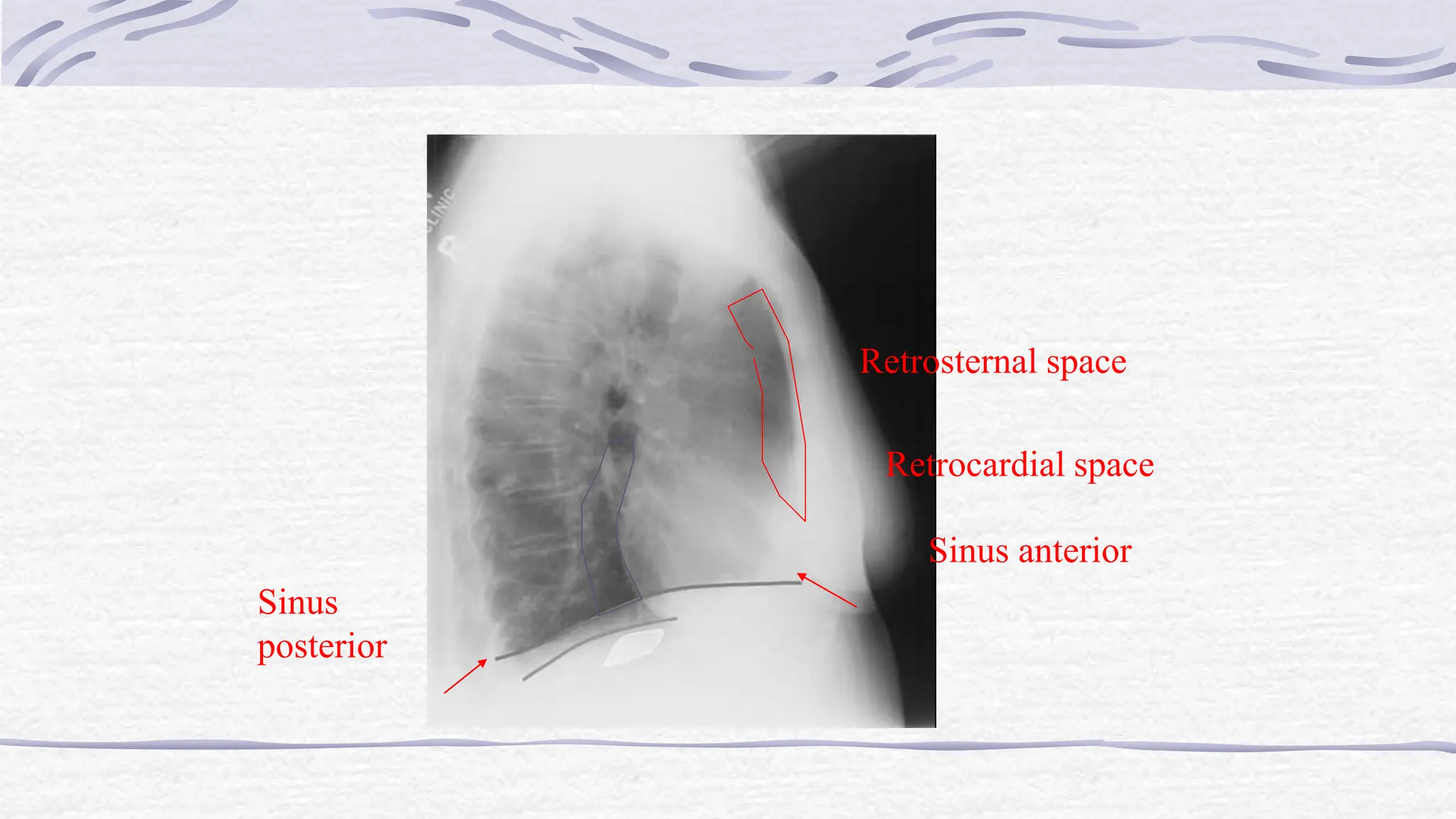 anatomy thorax human title radiologi positioning | PPTX