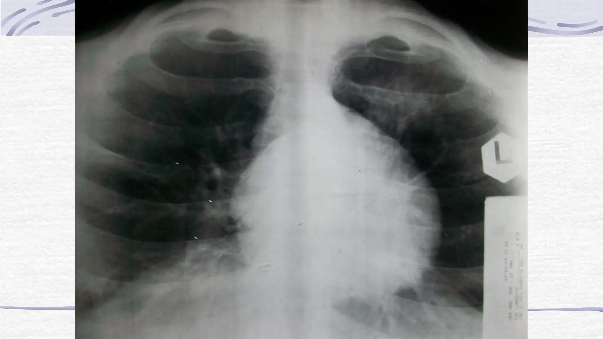 anatomy thorax human title radiologi positioning | PPTX