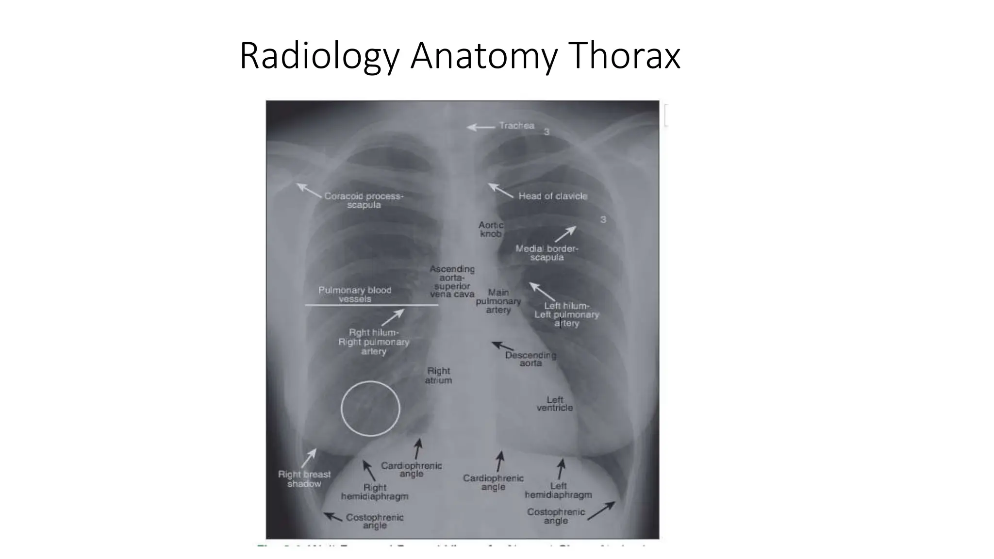 anatomy thorax human title radiologi positioning | PPTX
